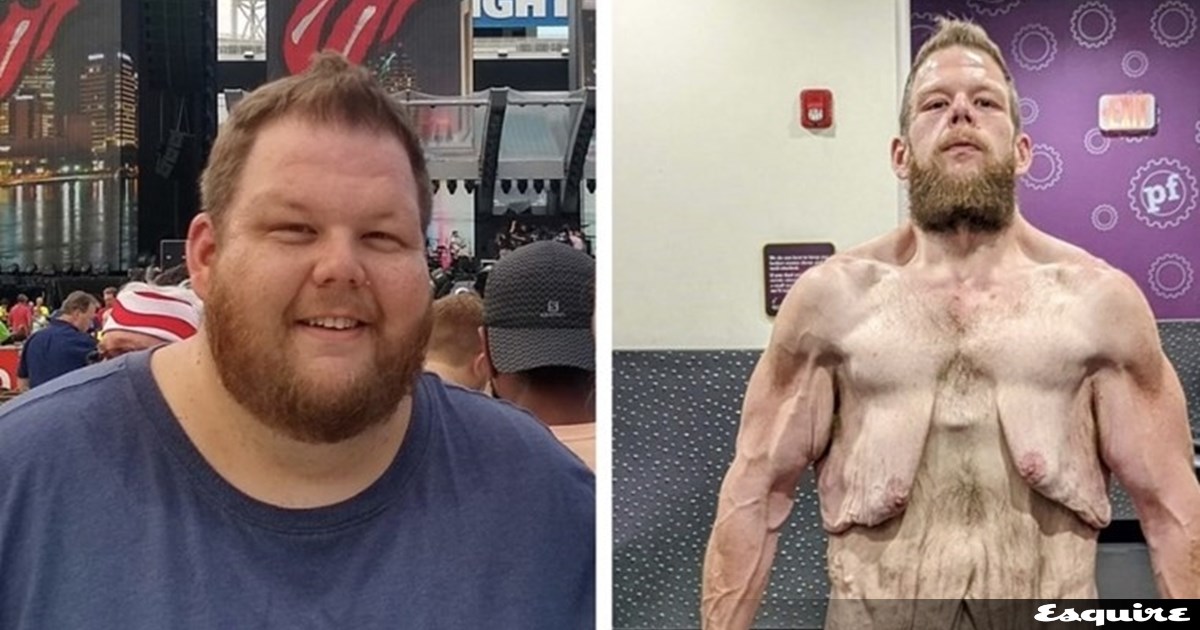 Cole Prochaska: Ο άνθρωπος που έχασε 152 κιλά